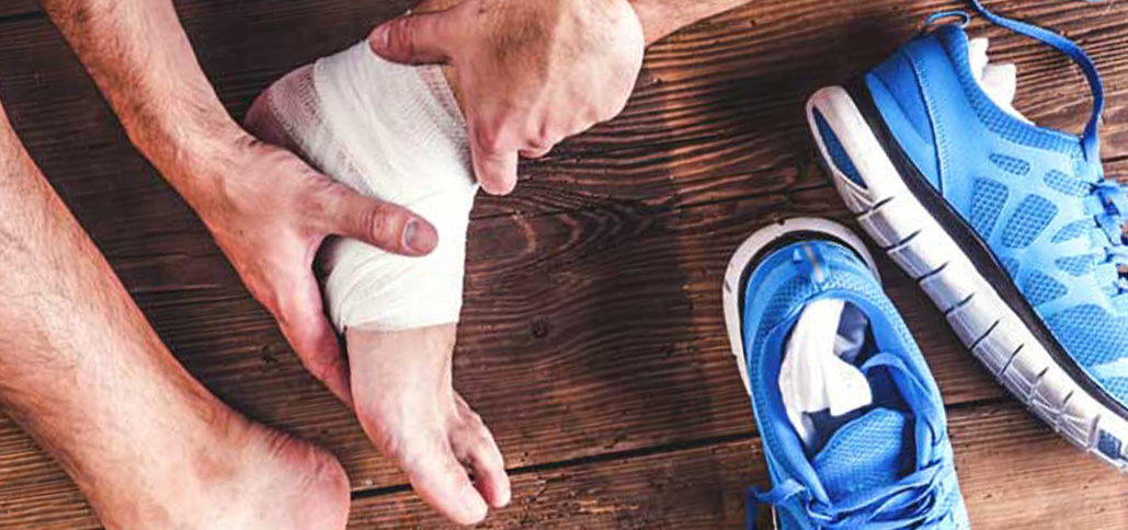 Entorse à la Cheville avec Arrachement Osseux : Comprendre et Gérer