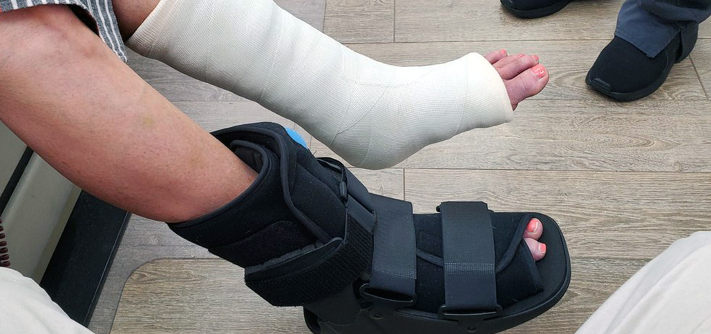 Entorse à la cheville, plâtre ou pas